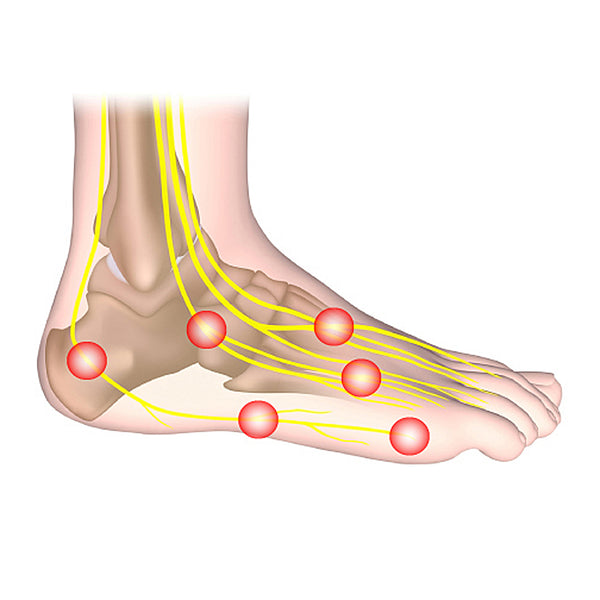 Evertone Pain Relief Compression Foot Sleeve Open Compression Sock- 2 ...